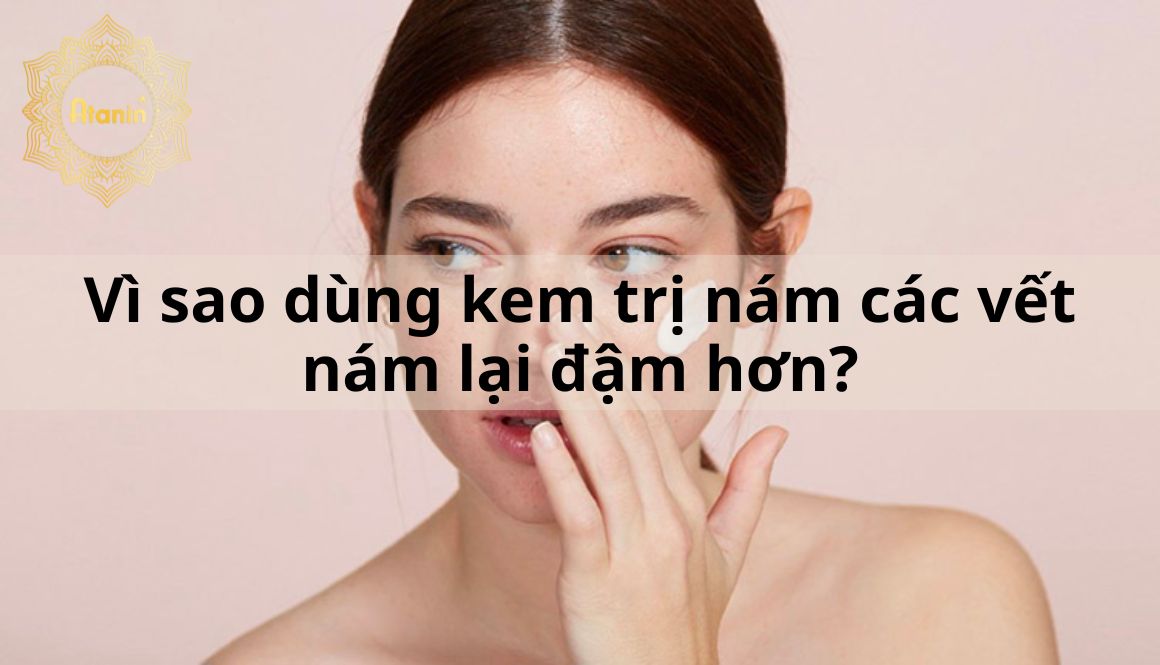 Vì sao dùng kem trị nám da xấu hơn? - Hanngocvananh